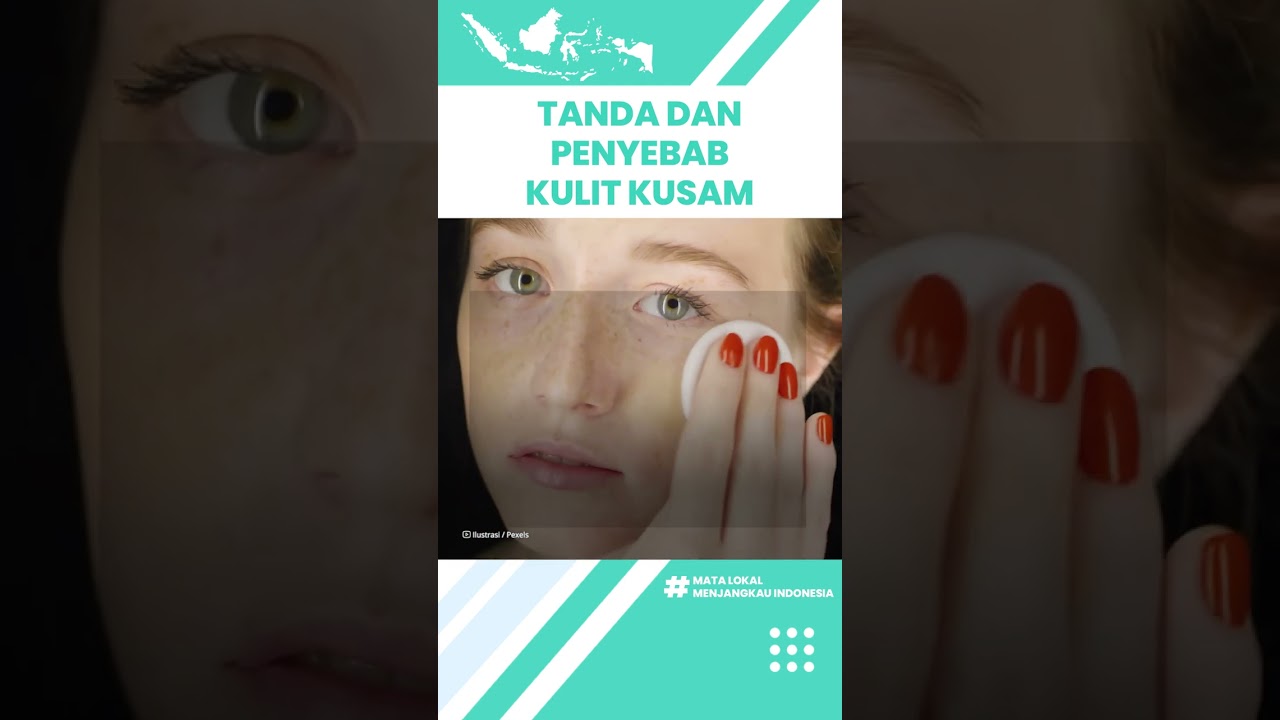 Inilah Tanda Dan Penyebab Kulit Kusam Yang Akibatkan Penuaan Dini