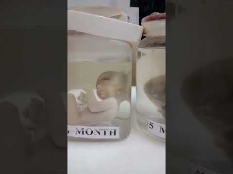 Stages of Real Baby's in mother womb