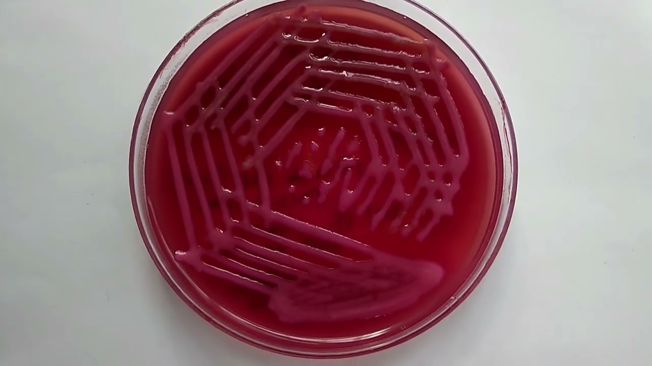 Klebsiella pneumoniae colony morphology on Macconkey agar Demonstration