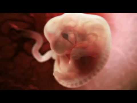 Why I Am Pro-Life? (And Why You Should Be Too) #prolife