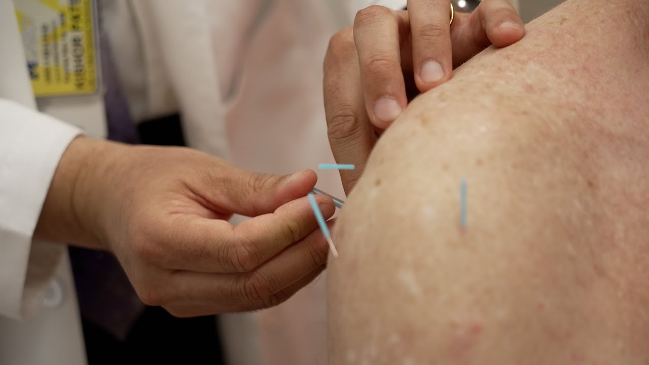 VAAAHS Acupuncture Service Spotlight