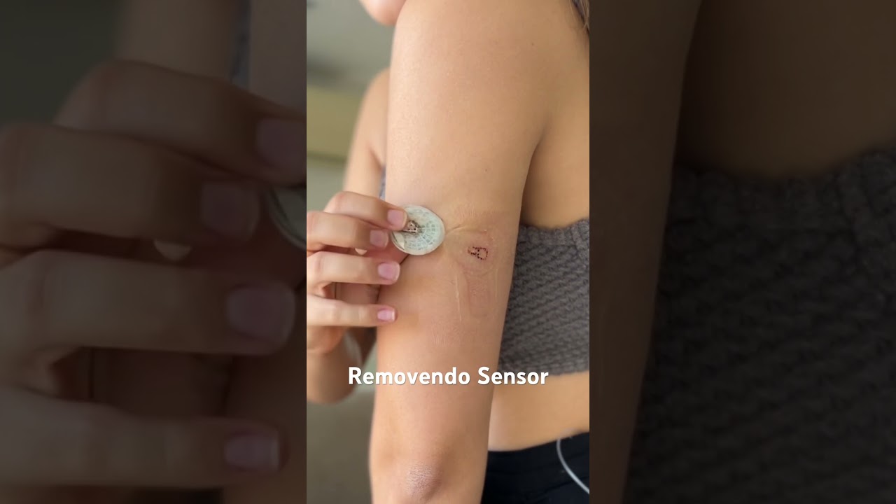 Removendo meu sensor FreeStyle Libre #diabetes #diabetestipo1 #dm1 #youtubeshorts #glicemia #sensor