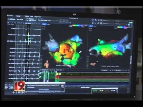 Rhythmia Heart Surgery - CBS 19