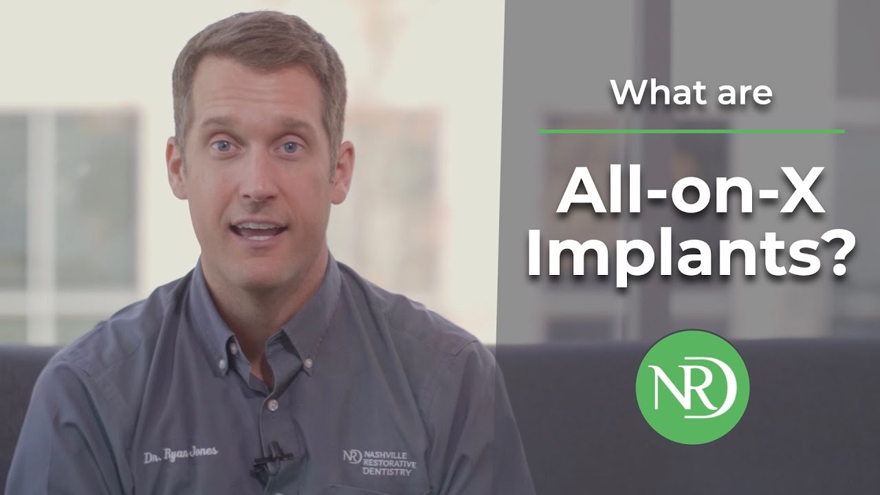 What are All-on-X implants?