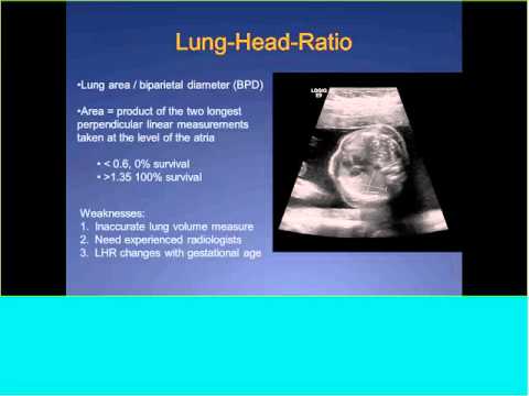 Topics in Fetal Medicine - Andrea Badillo, M.D. and Eva Rubio, M.D.
