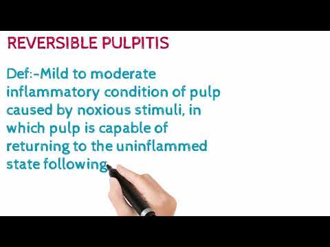 Reversible Pulpitis