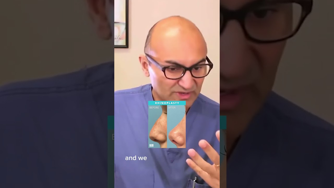 POST RHINOPLASTY SYNDROME - WHY YOU DON'T LIKE YOUR NEW NOSE - DR. TANVEER JANUA - NEW JERSEY