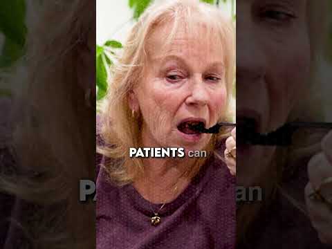 How Do All-on-X Dental Implants Change Lives?