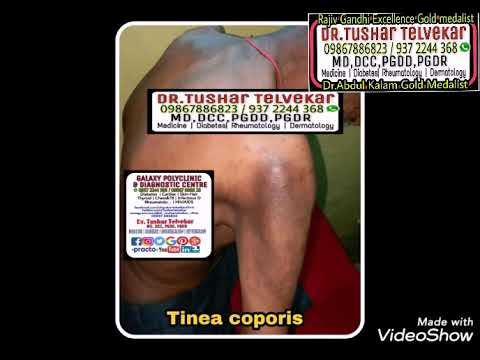 #Best_Skin_specialist_inMumbai_NaviMumbai #DrTusharTelvekar #consultantDermatologist