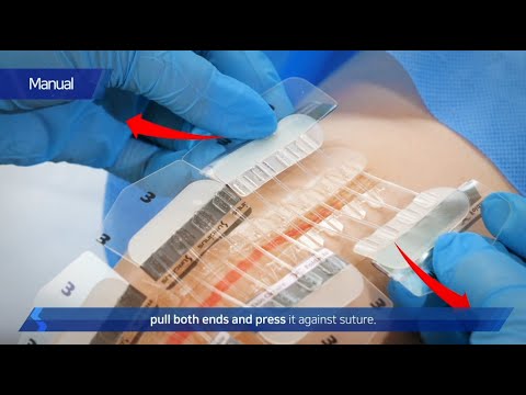 Foldable Skin Closure - Linkonbiz