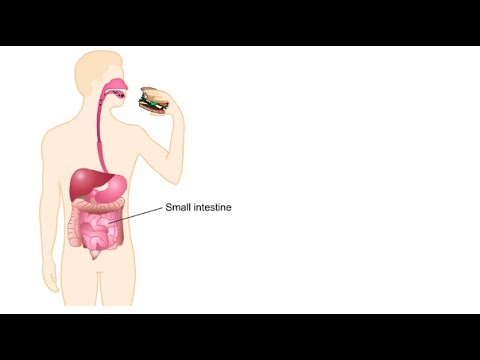 Dietary Cholesterol & LDL