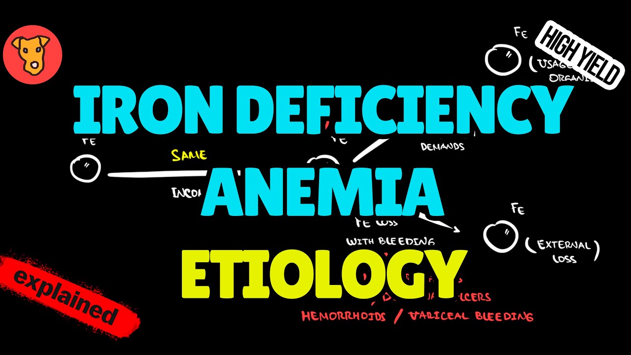 Iron Deficiency Anemia EXPLAINED: Etiology, Clinical Features & USMLE Insights (Beginner’s Guide)