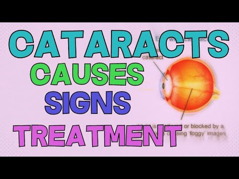 What are Cataracts? Cause Types Symptoms RAFD TREATMENT | NUCLEAR POSTERIOR SUBCAPSULAR CORTICAL