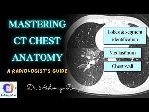 Mastering Chest CT- ANATOMY. Detailed anatomy with DIACOM discussion. Lung segments & mediastinum