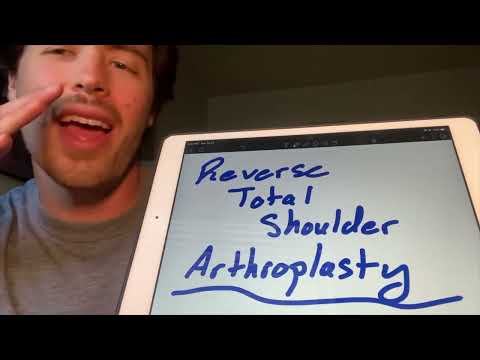 Reverse Total Shoulder Arthroplasty Simple Overview