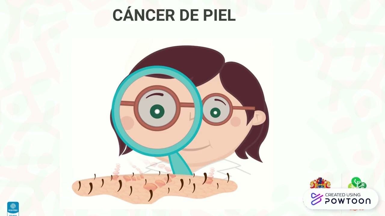 MATERIAL APS - CANCER ESTOMAGO Y PIEL.pptx
