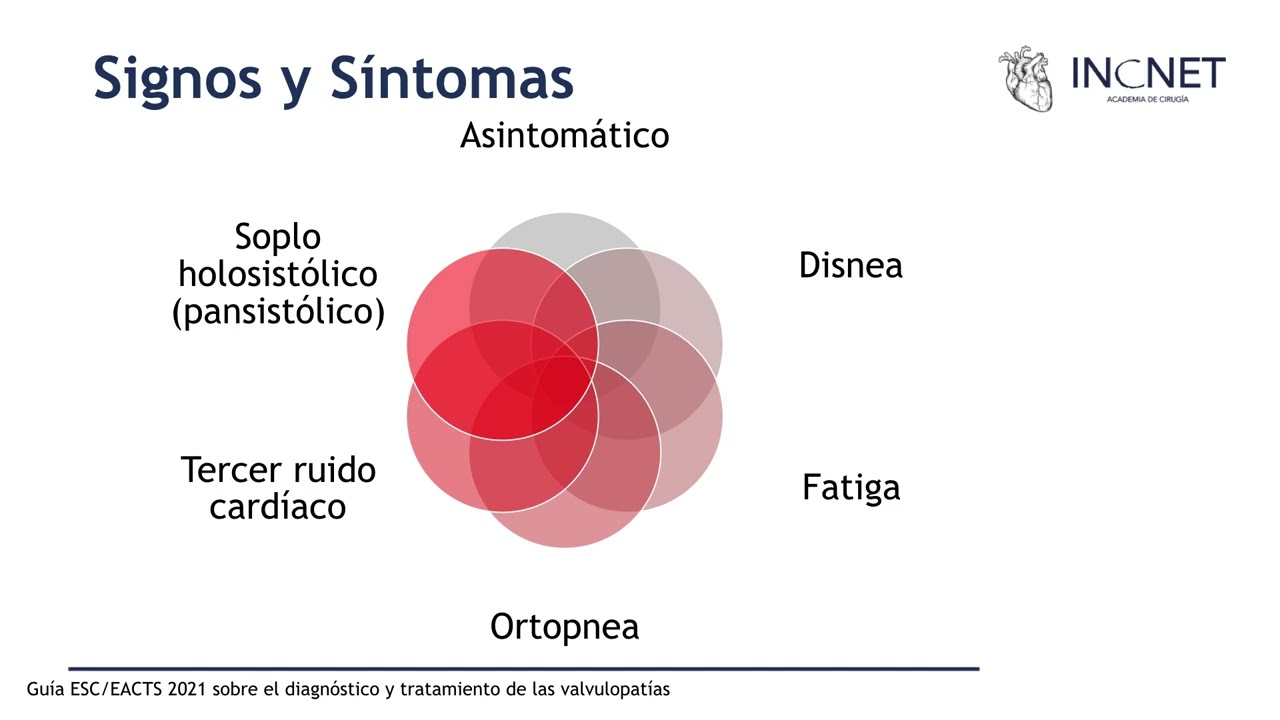 Insuficiencia Mitral Primaria