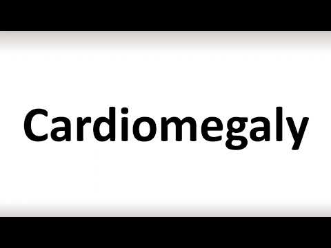How to Pronounce Cardiomegaly (correctly!)