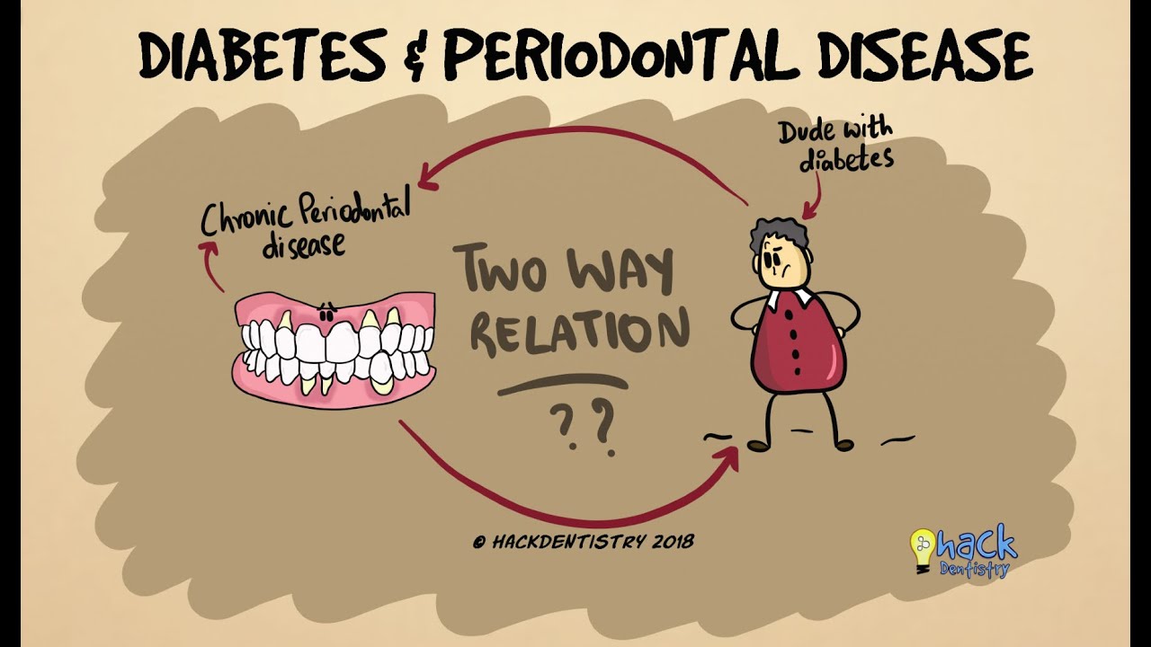 Diabetes and periodontitis: The two way relationship