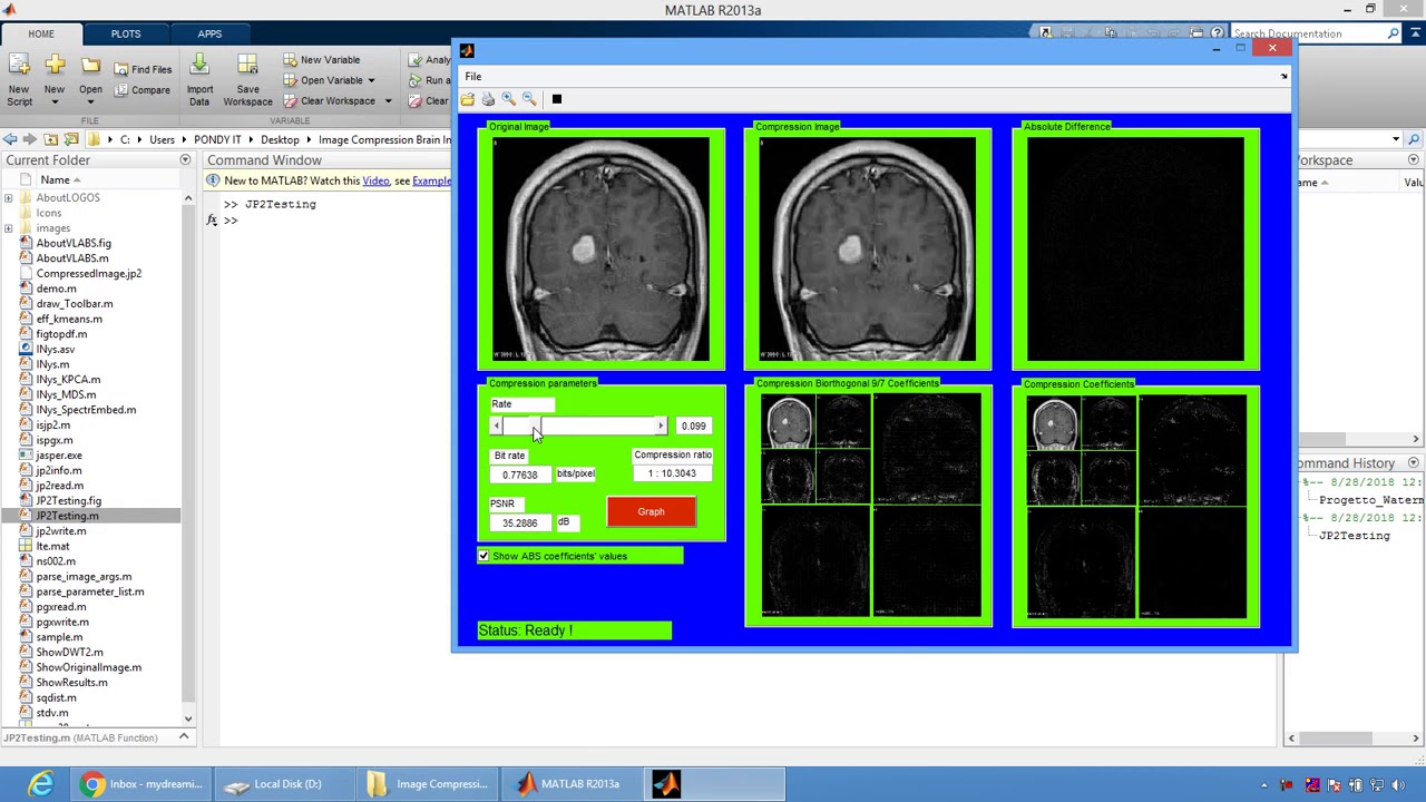 Image Compression Brain Image using Matlab