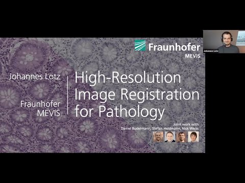 High-Resolution Image Registration for Computational Pathology: Johannes Lotz, 21st February 2022