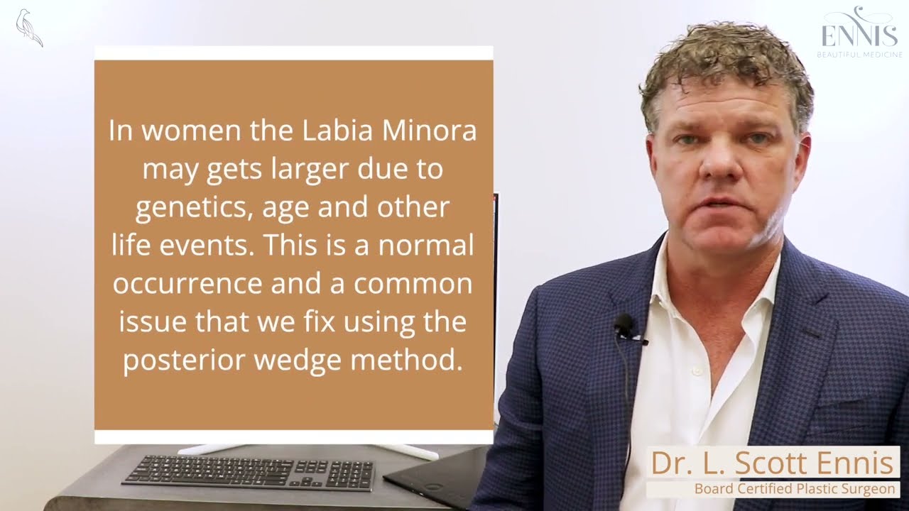 Labiaplasty Lifestyle Before & After with Dr. Ennis