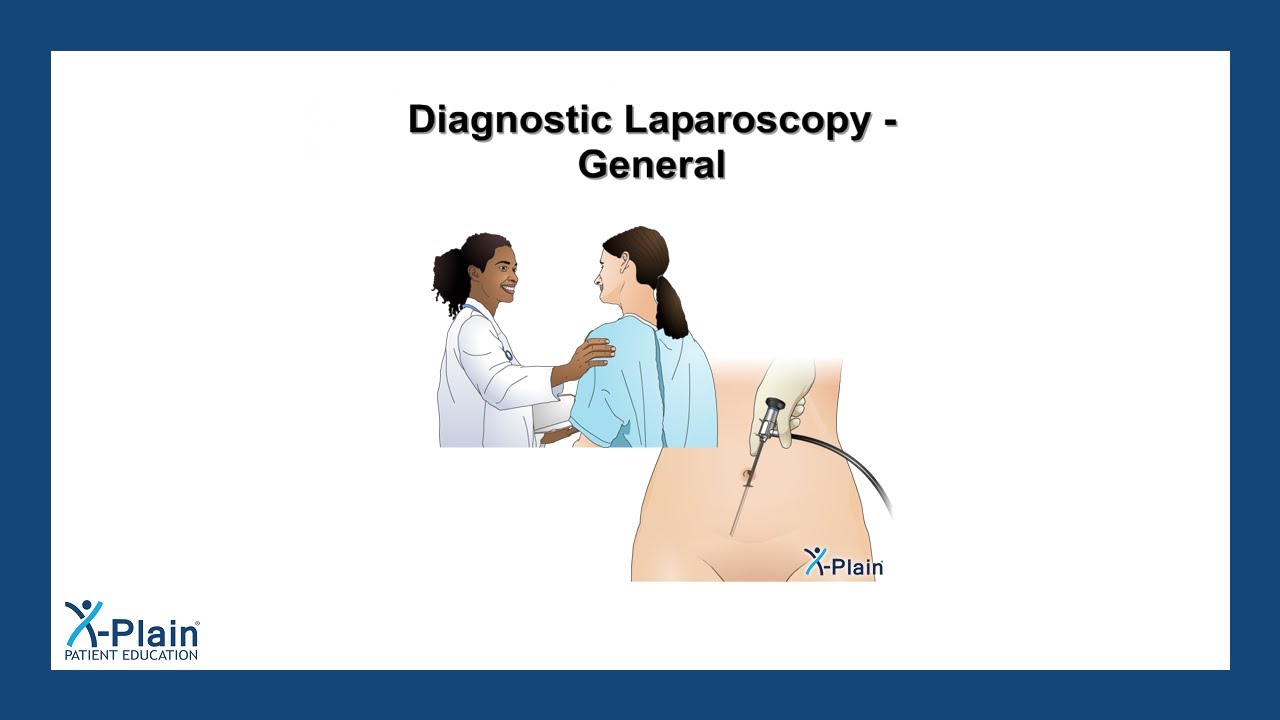 Diagnostic Laparoscopy - General