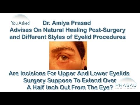 Natural Cycle of Healing and Different Styles of Cosmetic Eyelid Surgery