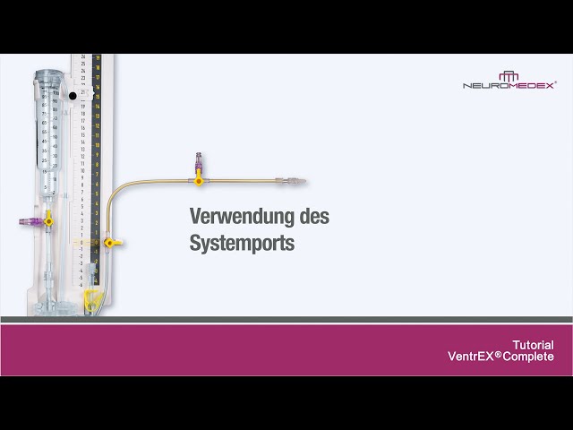 VentrEX® Complete EVD | Ventrex