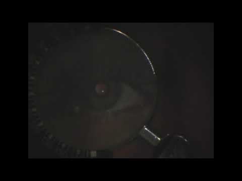 Retinoscopy Streak Simulated Astigmatism