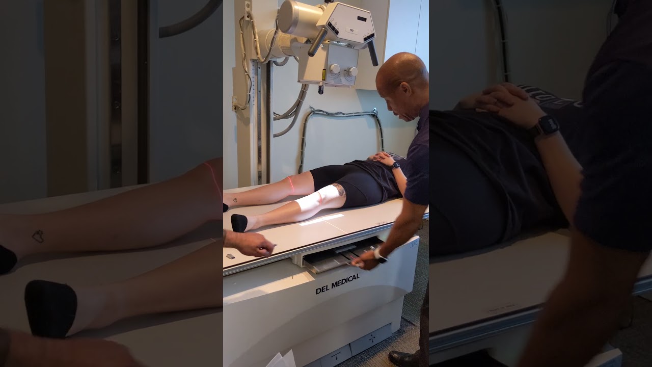 AP Oblique Knee - Lateral Rotation