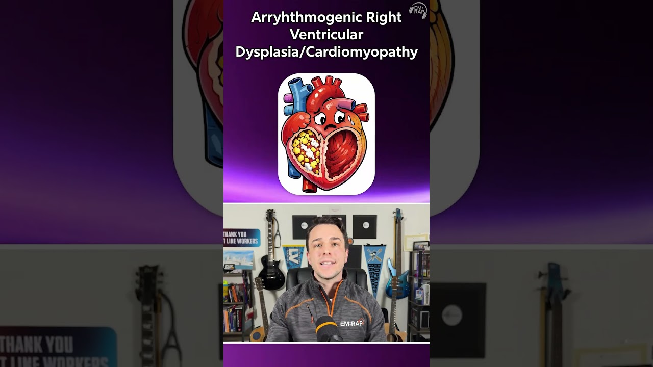 Syncope ECG: Don’t Miss These