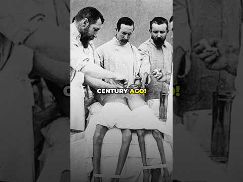 ● The First-ever Separation of Conjoined Twins ■ #MedicalMiracle #ConjoinedTwins #MedicalHistory