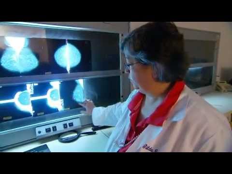 Patient-Focused Approach to Breast Imaging