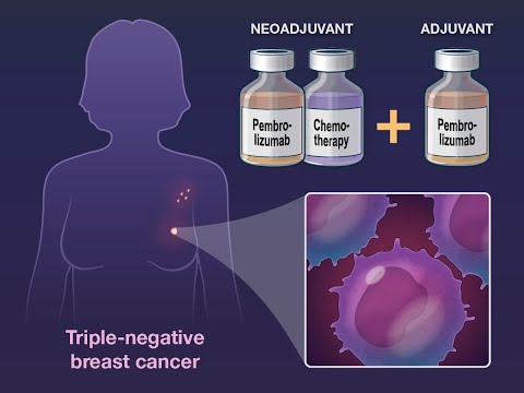Overall Survival with Pembrolizumab in Breast Cancer | NEJM