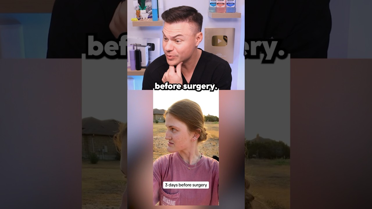 What REALLY Happens In A Double Jaw Surgery! 😬🦷