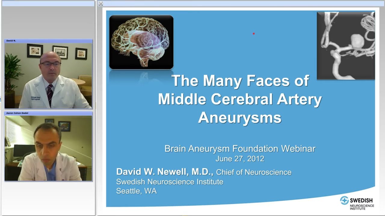 The Many Faces of Middle Cerebral Artery Anurysms (Preview)