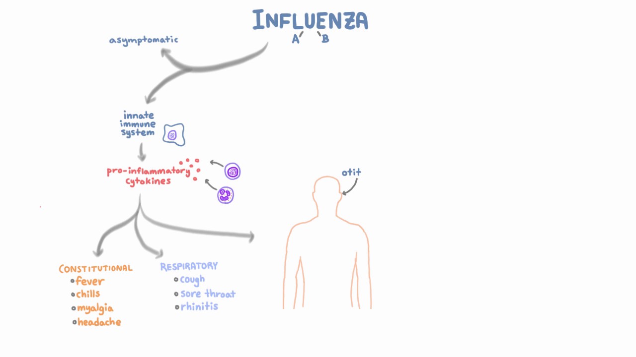 Influenza Infection - Clinical Symptoms and Presentation