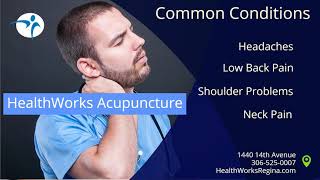 3 Best Acupuncture in Regina, SK - Expert Recommendations