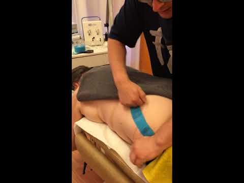 6D Tape for scar tissue