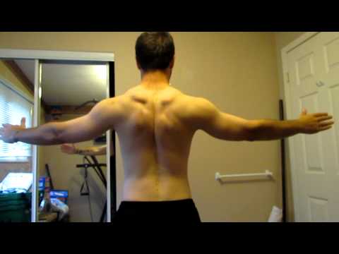 Assessing shoulder motion (an illustration of humeral anterior glide ...