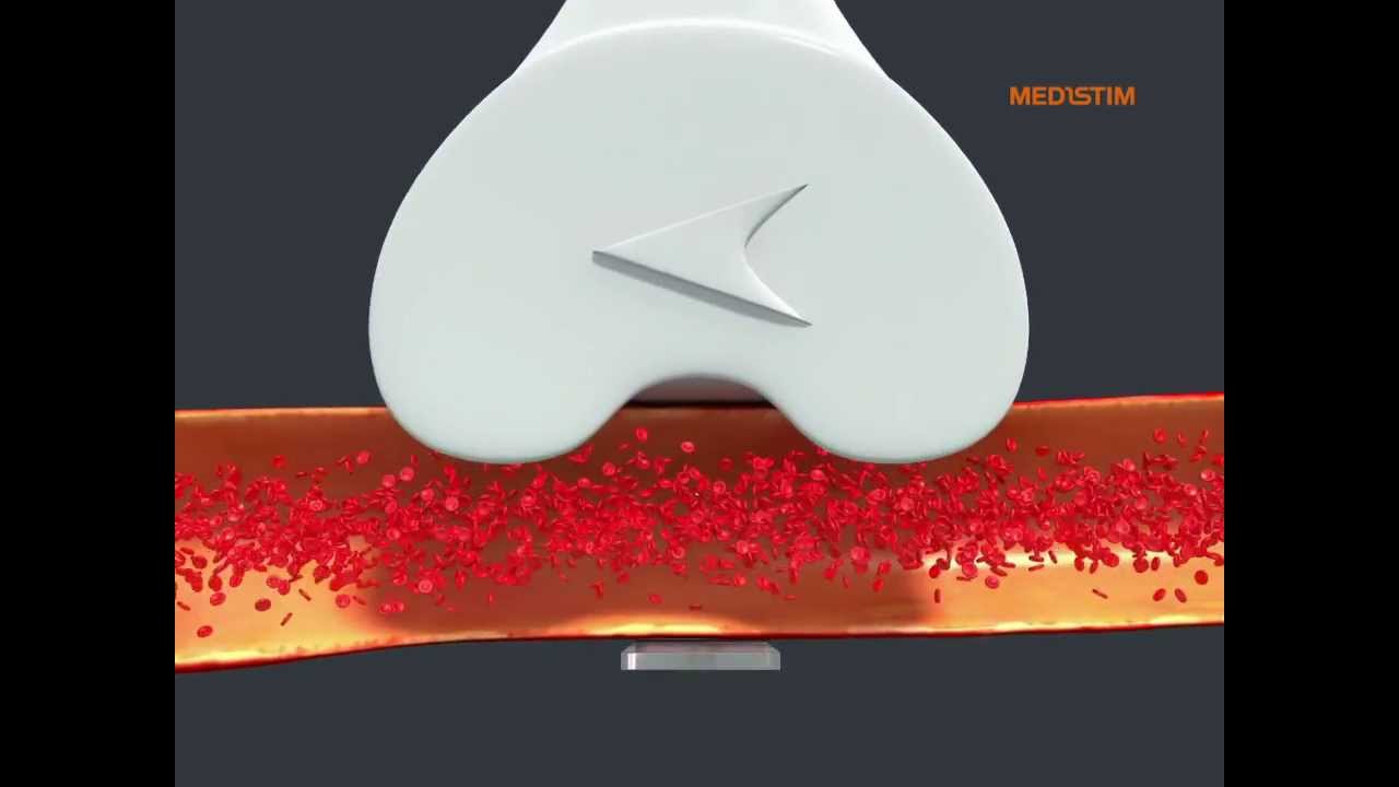 Transit Time Flow Principle