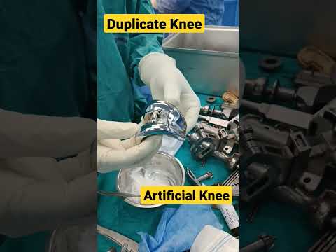 Total Knee Replacement ✓ | #totalkneereplacementsurgery #kneereplacementoperation #kneearthritis