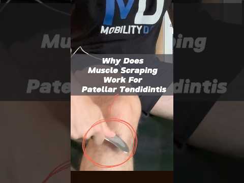 Why Muscle Scraping for Patellar Tendinitis Works 💪