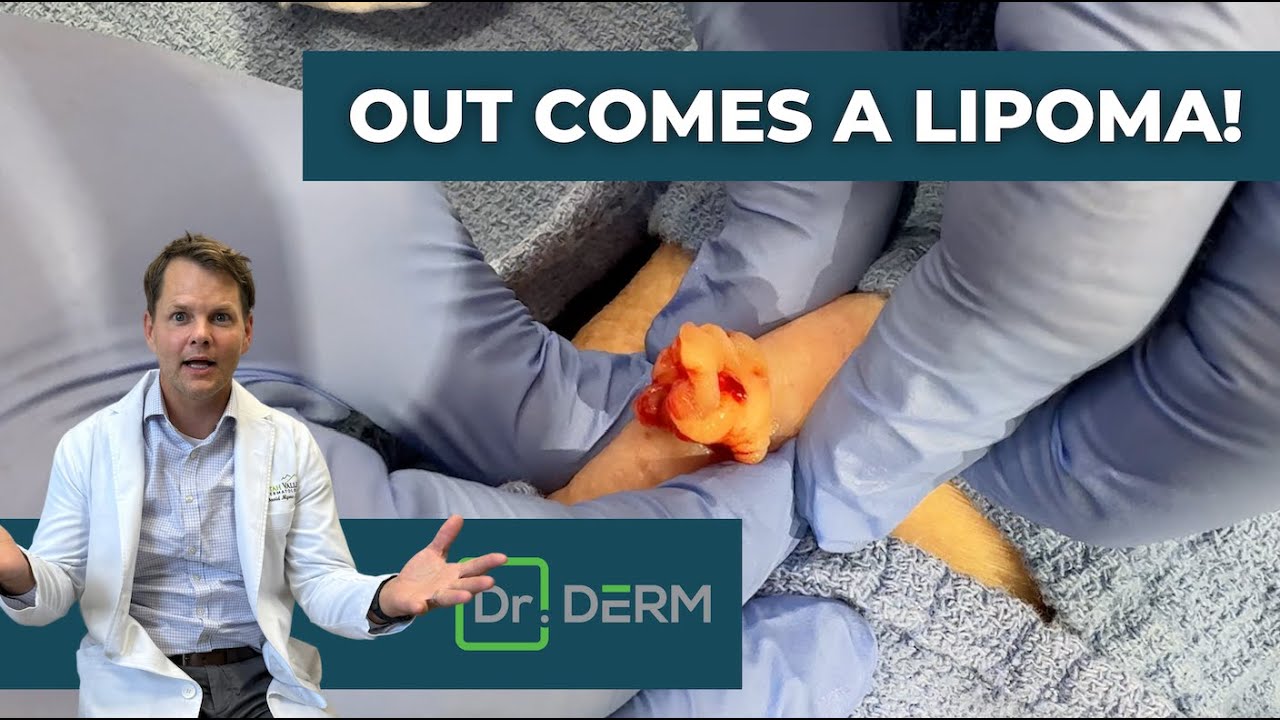 Videos - Utah Valley Dermatology