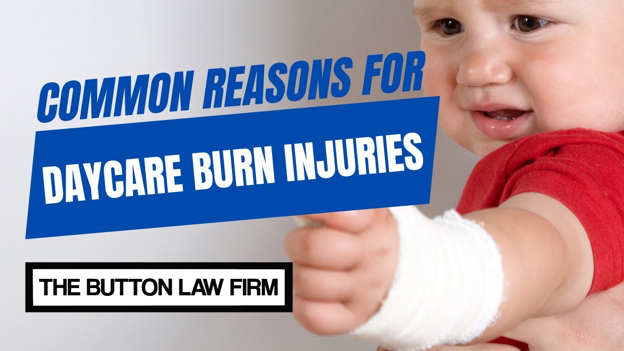 The Most Common Burn Injuries That Happen at Daycare | The Button Law ...