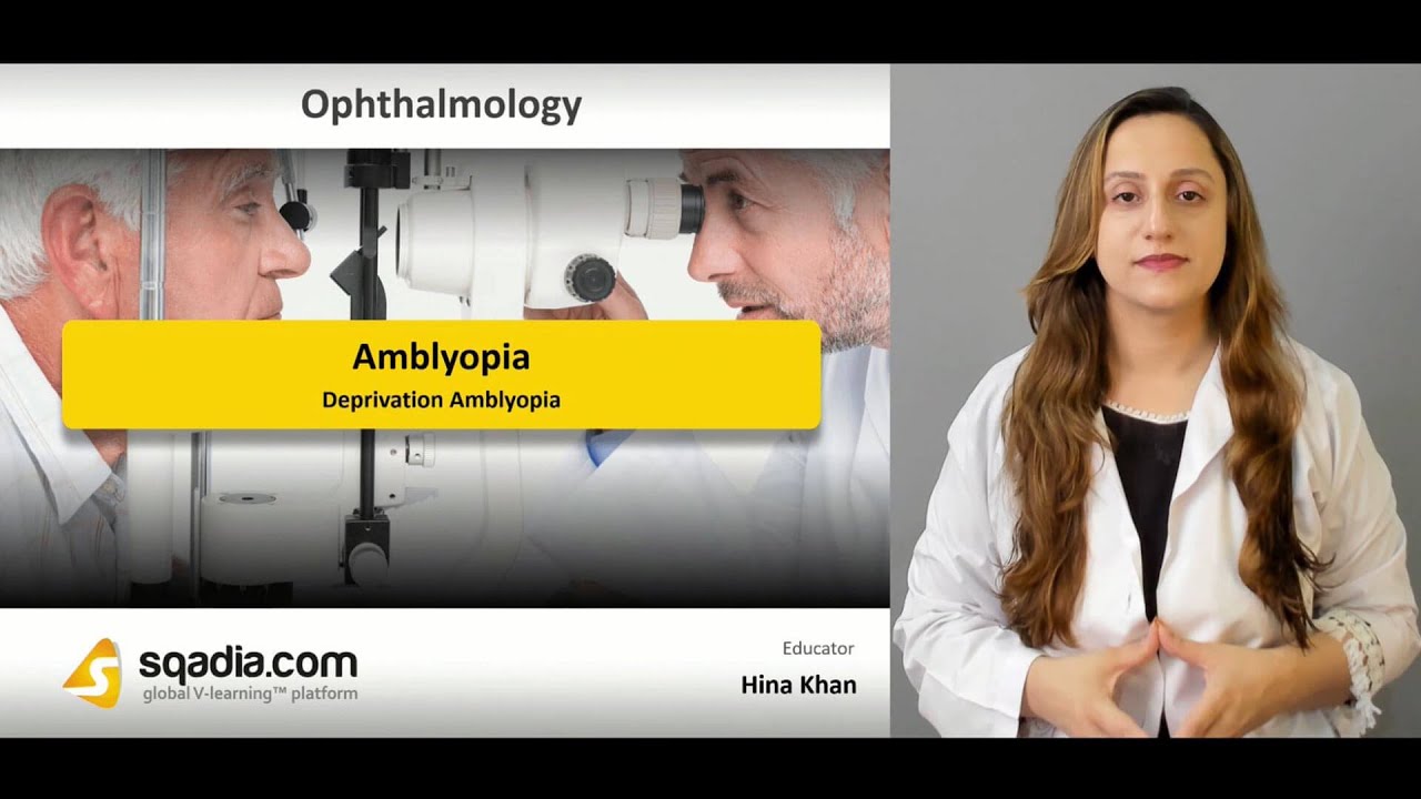 Amblyopia - Deprivation Amblyopia