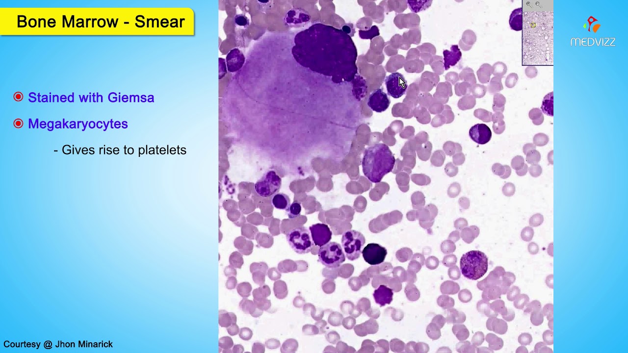 Histology Bone marrow smear : Shotgun Histology