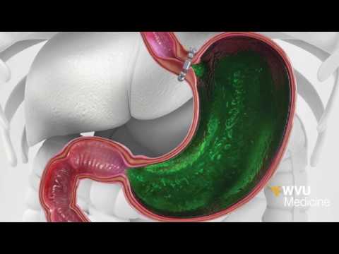 WVU Medicine Health Report: Esophageal Cancer Awareness Month