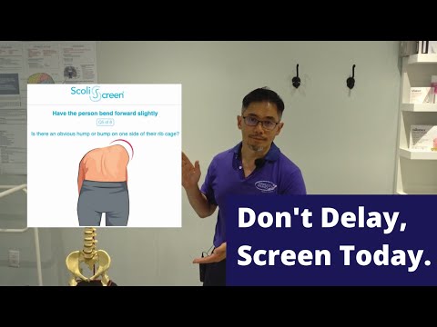 Scoliosis Screening | Ask Dr. James